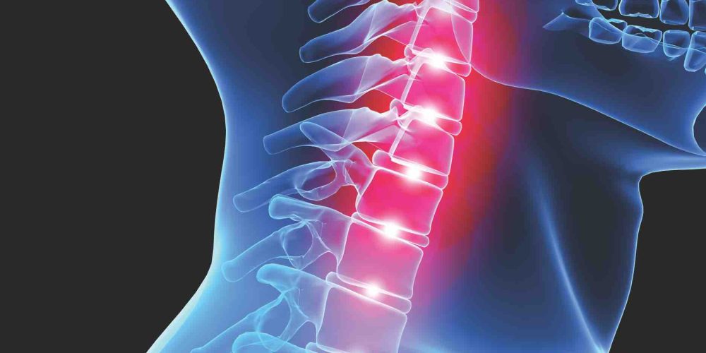 Quoi faire si vous avez mal au cou? - Polyclinique du Lac